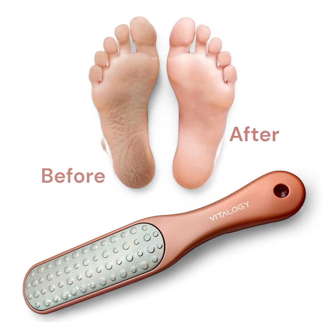 Dual Sided Stainless Steel Foot Filer | Wet & Dry Callus – Salon Designers